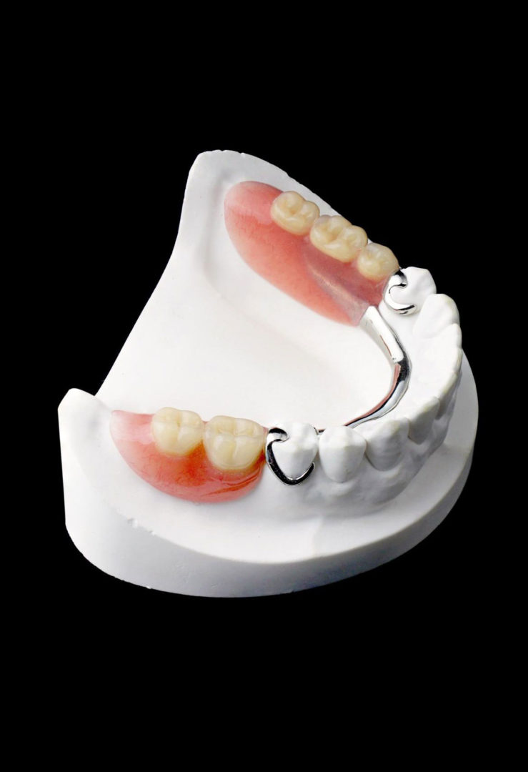 How Dentures Can Improve Your Oral Health and Overall Wellbeing How Dentures Can Improve Your Oral Health and Overall Wellbeing